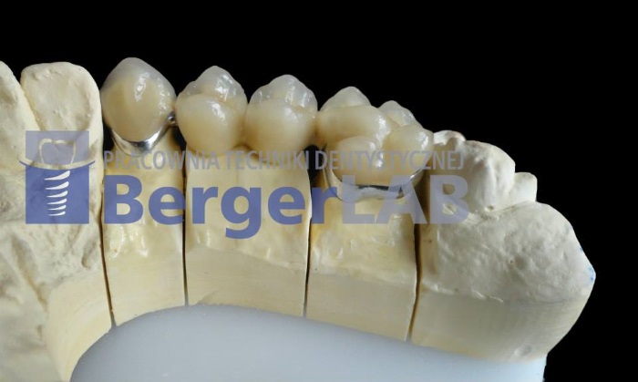 Realizacje | Duodent